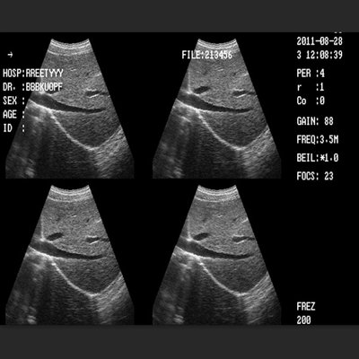 Human Portable Ultrasound Scanner with 18-month warranty/CE Ultrasonic with factory support/USG echo device/Sonography
