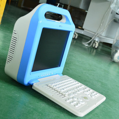 Laptop Ultrasound Scanner/CE&ISO Ultrasonic Machine/6kgs USG machine/Sono echo device with 18-month warranty