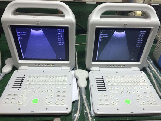 Laptop Ultrasound Scanner/CE&ISO Ultrasonic Machine/6kgs USG machine/Sono echo device with 18-month warranty
