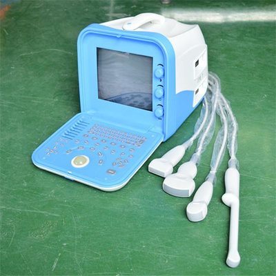 Handheld Ultrasound Machine/Factory USG scanner/ECho sonography/Human ultrasonic device with 18-month warranty