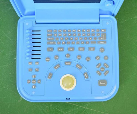 Handheld Ultrasound Machine/Factory USG scanner/ECho sonography/Human ultrasonic device with 18-month warranty