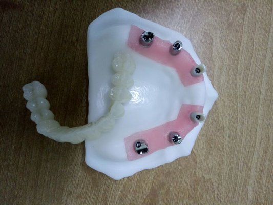 CAD / CAM Custom Titanium / Zirconia Abutments Dental Model With Digital 3D Printing