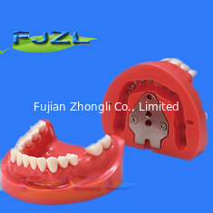 China dental model for partial denture restorative supplier