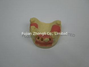 China dental implant material bone graft implant for suturing supplier