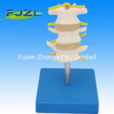 China Medical Science Normal 3pcs Lumbar set, Lumbar Vertebrae, Human Joint Model supplier