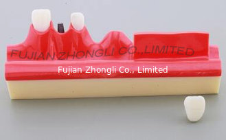 China Dental implanting step demonstration red strip planting demonstration model implanting nail display crown configuration supplier