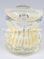 China Dental Transparent Standard Model of 3 - year - old Alternative Model supplier