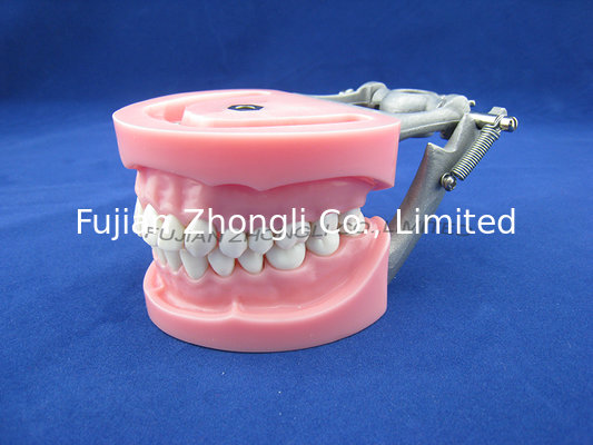 typdont teeth model for abutment supplier