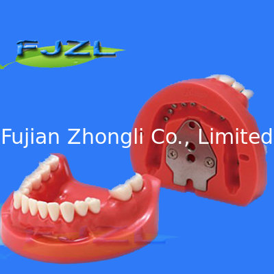 dental model for partial denture restorative supplier