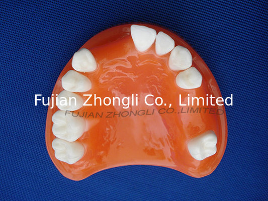 dental model for partial denture restorative supplier