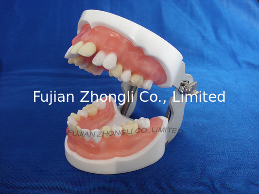 typodent dental jaw model for practice extract tooth supplier