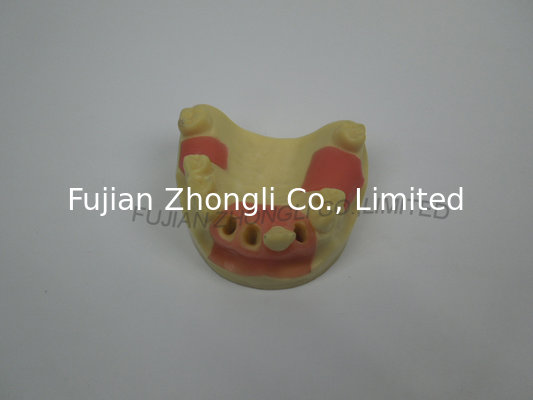 dental implant material bone graft implant for suturing supplier