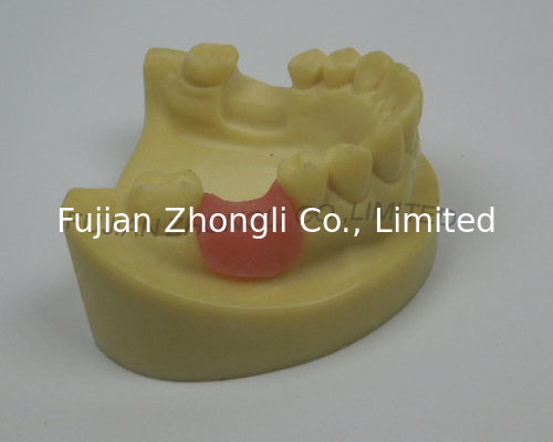 dental implant material bone graft implant for suturing supplier