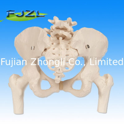 Medical Human Pelvis Lumbar Spine And Femoral Head supplier