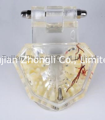 Transparent prothetic with implant model dental nerve demonstrate model doctor-patient communication model supplier