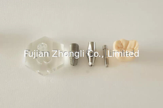 dental implant demonstration model of 5 parts supplier