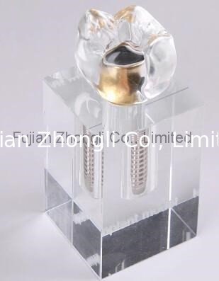 dental implant crystal model of 3 parts supplier