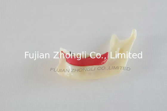 Dental Half Lower Jaw Open Gum Bone Pathological Diseases supplier