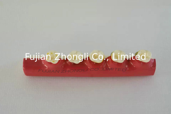 Dental 2 times larged periodontal disease progress model supplier