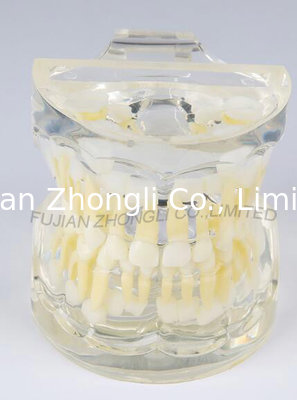 Dental Transparent Standard Model of 3 - year - old Alternative Model supplier