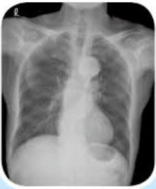 Impresoras térmicas de Agfa que imprimen productos médicos de la película del laser X Ray de la imagen de Digitaces