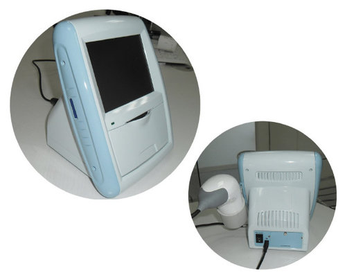 Escáner portátil tamaño pequeño de la vejiga del ultrasonido de la máquina 3D del ultrasonido de la vejiga para la urología
