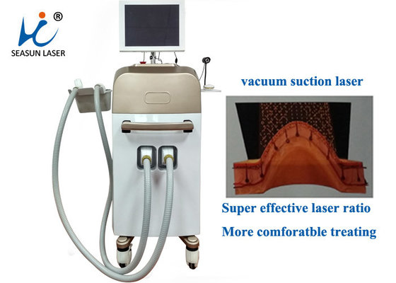 Vacuum Laser Therapy Lightsheer Duet Diode Hair Removal Permanent For Face