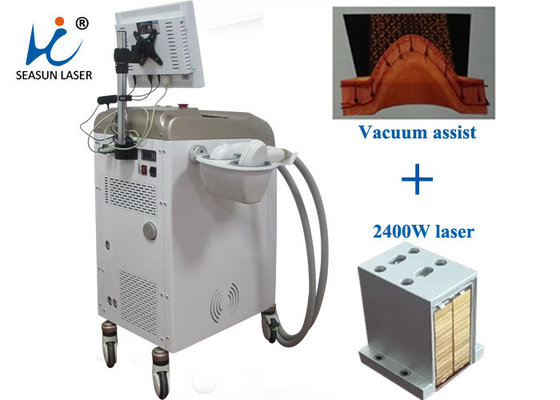 Most Effective Hair Loss Treatment Permanent Hair Removal Machine For Bikini Area