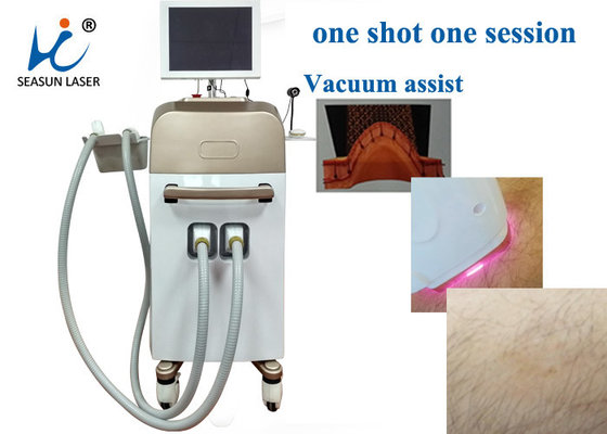 High Speed Vacuum Assisted Diode Laser Treatment For Hair Removal , Small Size