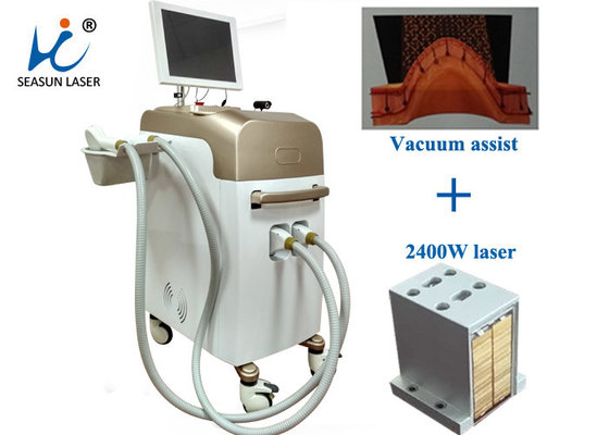 Most Effective Hair Loss Treatment Permanent Hair Removal Machine For Bikini Area