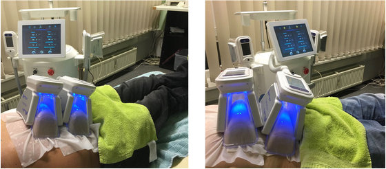 High quality cryolipolysis body slimming machine with 4 cryo handles