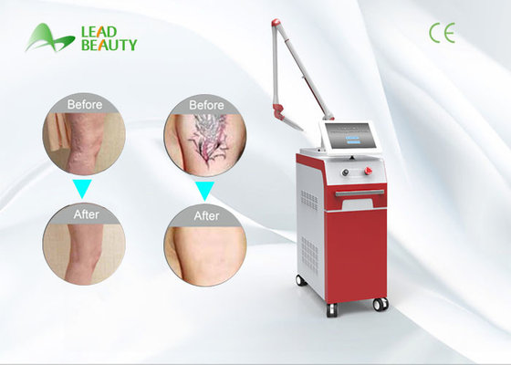 Vertical 1064nm 532nm Q-Switched ND YAG New Laser tattoo removal machine