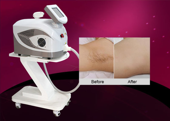 Powerful Laser Treatment Diode Laser Hair Removal Machine With Sapphire Crystal