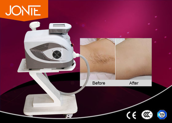 Pain-Free Diode Laser Hair Removal Machine , Alma SopranoSHR 810nm Laser Hair Removal