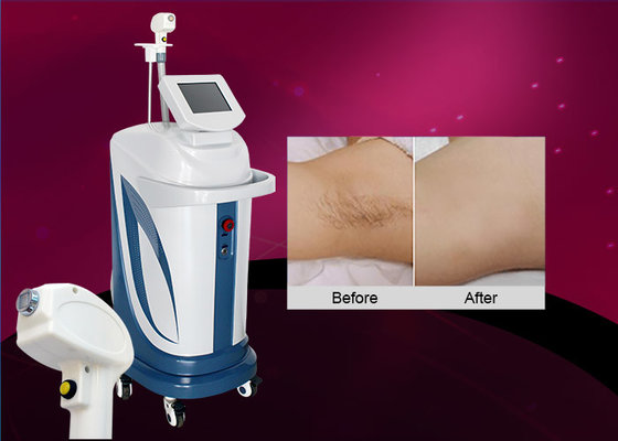 Painless Lightsheer Diode Laser Hair Removal Machine On All 6 Skin Types