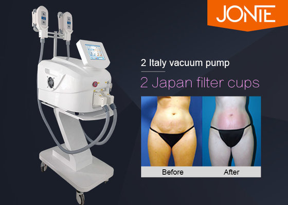 Professional Cryolipolysis Slimming Machine 60Hz Safety Cellulite Removal Device