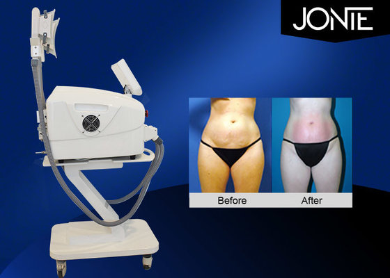 RF Vacuum Fat Freeze Slimming Machine Skin Tightening Beauty White / Gray Device