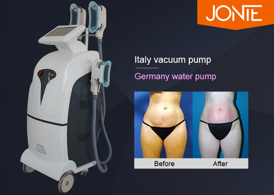 Four Handles Portable Cryolipolysis Facial Machines For Full Body Slimming Face Lifting