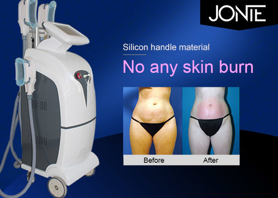 Sculpture Fat Freeze Cryolipolysis Machine , Weight Loss Equipment Slimming Machine 2000 Watt