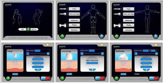 2016 Sanhe CE appoved Newest Technology Hifu , Hifu Face Lift ,hifu lose weight Hifu Machi