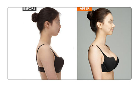 Vacuum therapy Electric Machine Big Beauty butt Breast Enlargement cupping machine supplier