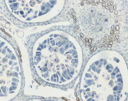 Biological Microscope For CASA IVF Semen Analysis Laboratory Microscope supplier