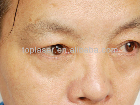 IPL Multifunction Beauty Equipment Professional For Skin Lifting