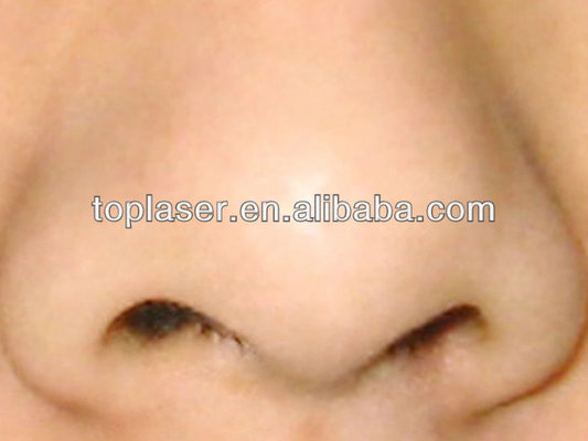 Female Face Lifting Skin Rejuvenation Equipment PDT With Touch Screen