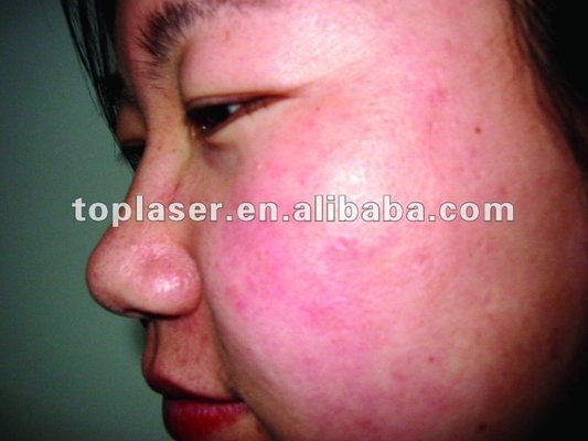Pain Free Ipl Hair Removal Machine , IPL Beauty Skin Tightening Machine