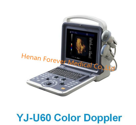 Diagnostic System Full Digital Color Doppler Ultrasound Scanner (YJ-U60)