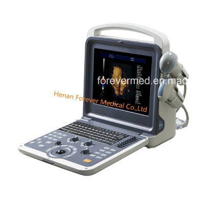 Diagnostic System Full Digital Color Doppler Ultrasound Scanner (YJ-U60)