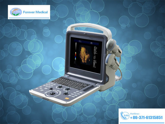 Diagnostic System Full Digital Color Doppler Ultrasound Scanner (YJ-U60)