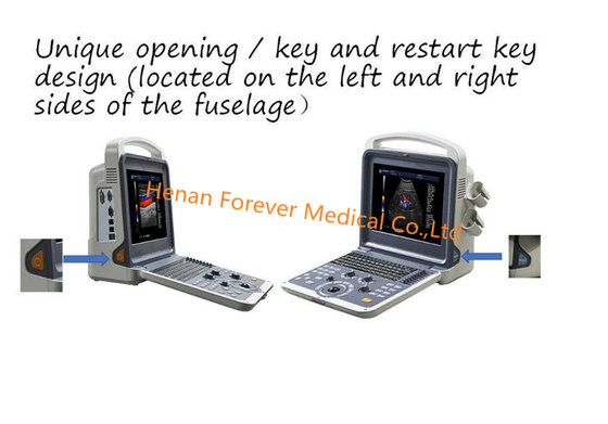 Medical Diagnosis Equipment 3D/4D Color Doppler Ultrasound