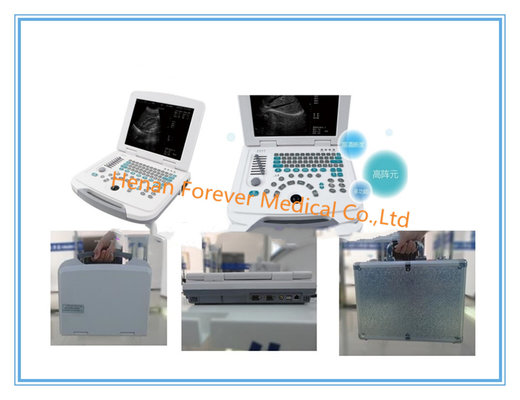 Clinical Hospital Used Full-Digital Laptop Ultrasound Scanner (YJ-U500)